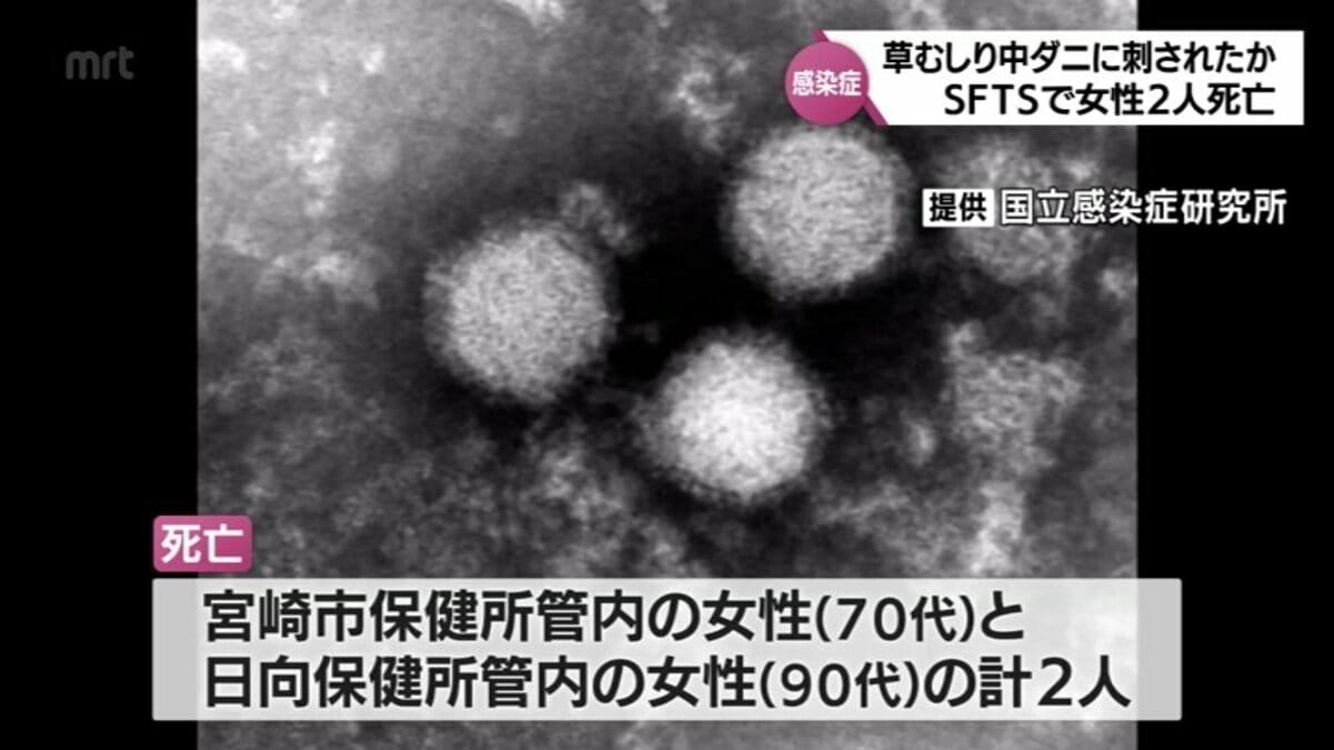 マダニが媒介する感染症「SFTS」 宮崎県内で女性2人が死亡 2人とも感染前に「草むしり」 | TBS NEWS DIG