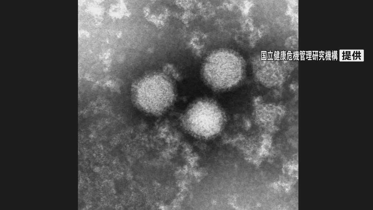 【速報】マダニ媒介の感染症 SFTSの感染者数が過去最多に | TBS NEWS DIG