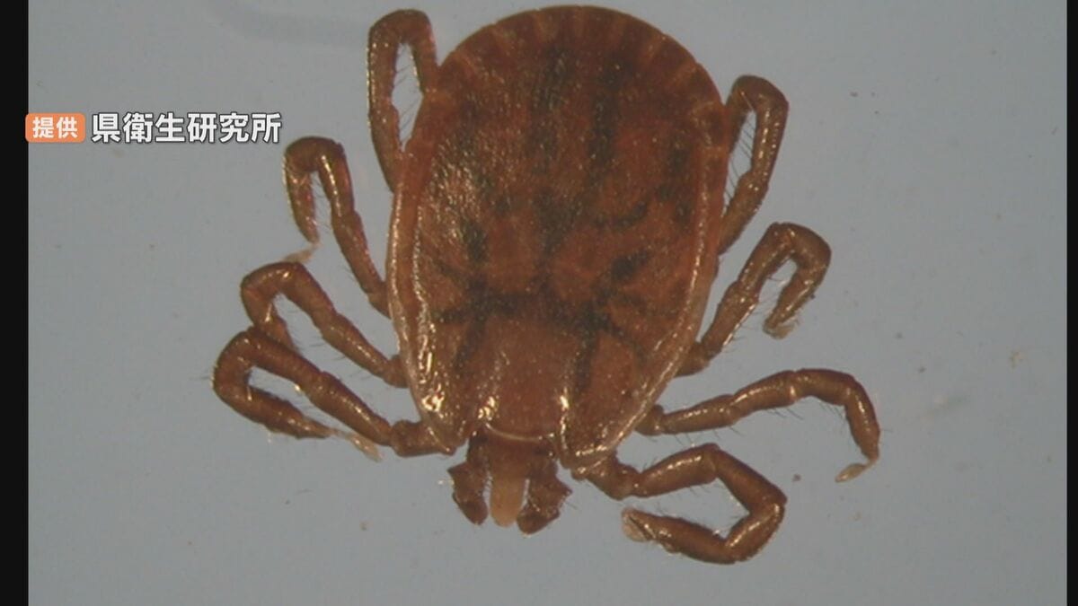 80代女性がマダニ媒介「SFTS」に感染 富山県で2例目の感染確認 農作業やレジャー、野外活動時は対策を | TBS NEWS DIG