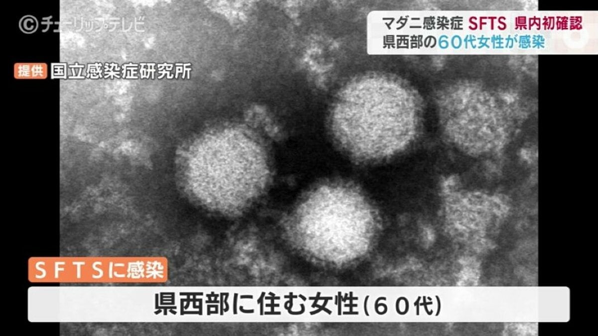 冬の間も注意 マダニ感染症SFTS 富山県内で初確認 県西部の60代女性が感染 | TBS NEWS DIG