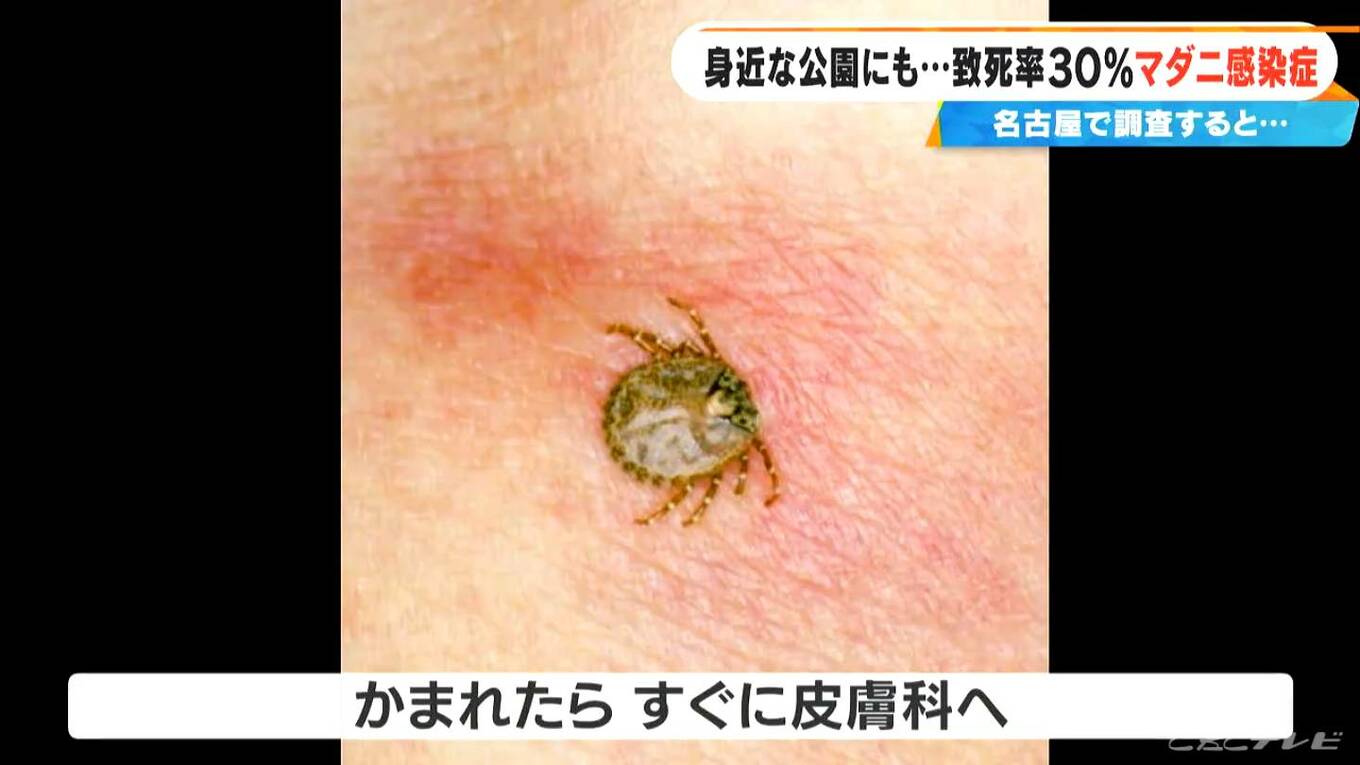 血液吸う機会を狙っている… 感染症=SFTSを媒介することもある「マダニ」専門家に生息場所やかまれた時の対処法を聞いた | TBS NEWS DIG (3ページ)