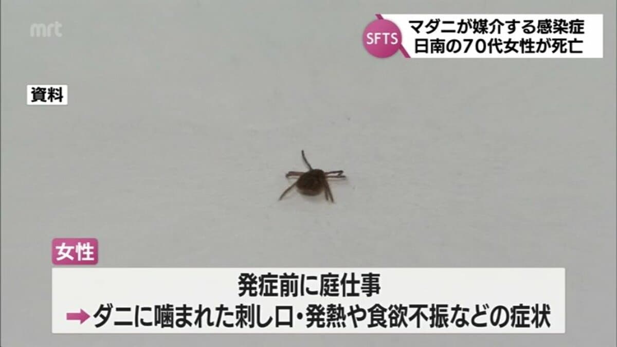 マダニが媒介する感染症「SFTS」に感染 日南市の70代女性が死亡 | TBS NEWS DIG