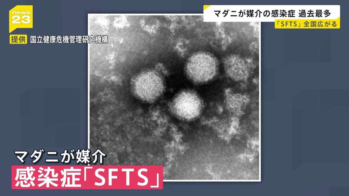 マダニ媒介の感染症「SFTS」感染者数が過去最多 今月10日までに135人 国内患者の致死率は27% 草の茂った場所では長そで・長ズボンの着用呼びかけ 厚労省 | TBS NEWS DIG