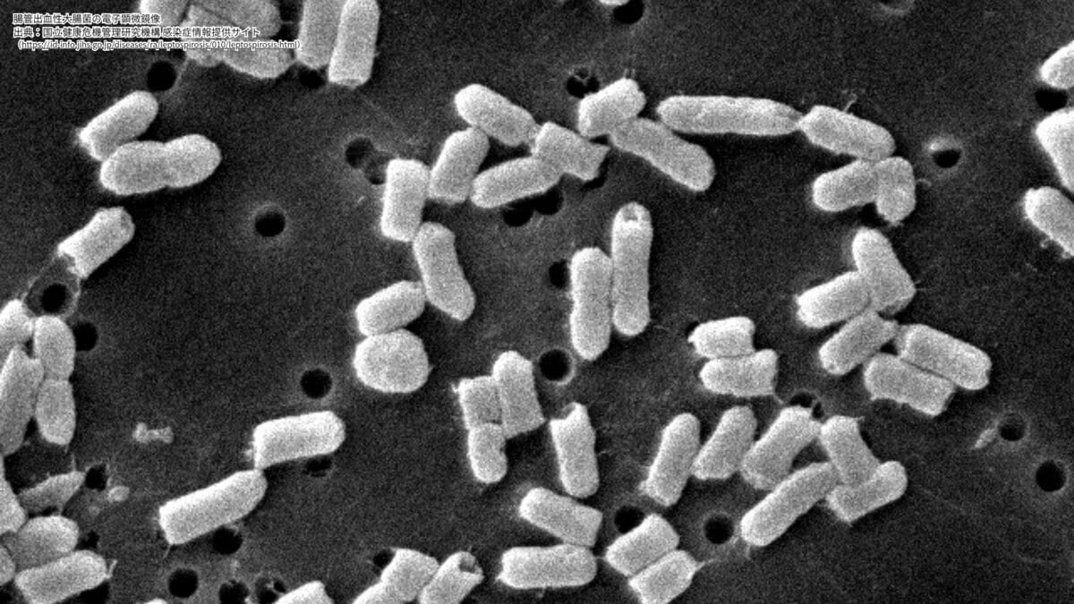 大腸菌「O157」など食中毒 集団感染で170人が発症 修学旅行で沖縄を訪れた1都3県の高校生ら | TBS NEWS DIG